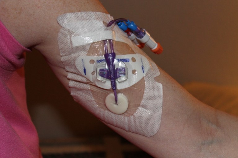 Lines, Leads, Tubes and Drains…Oh My! – OT Caroline